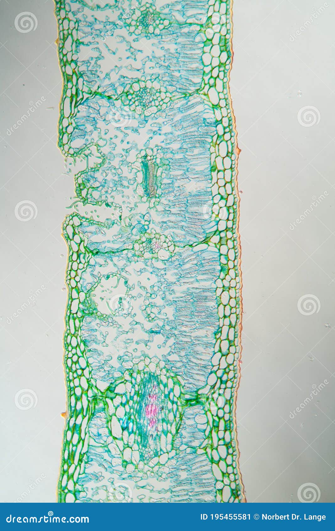 Weed Leaf Cross Section Under the Microscope Stock Image - Image of ...