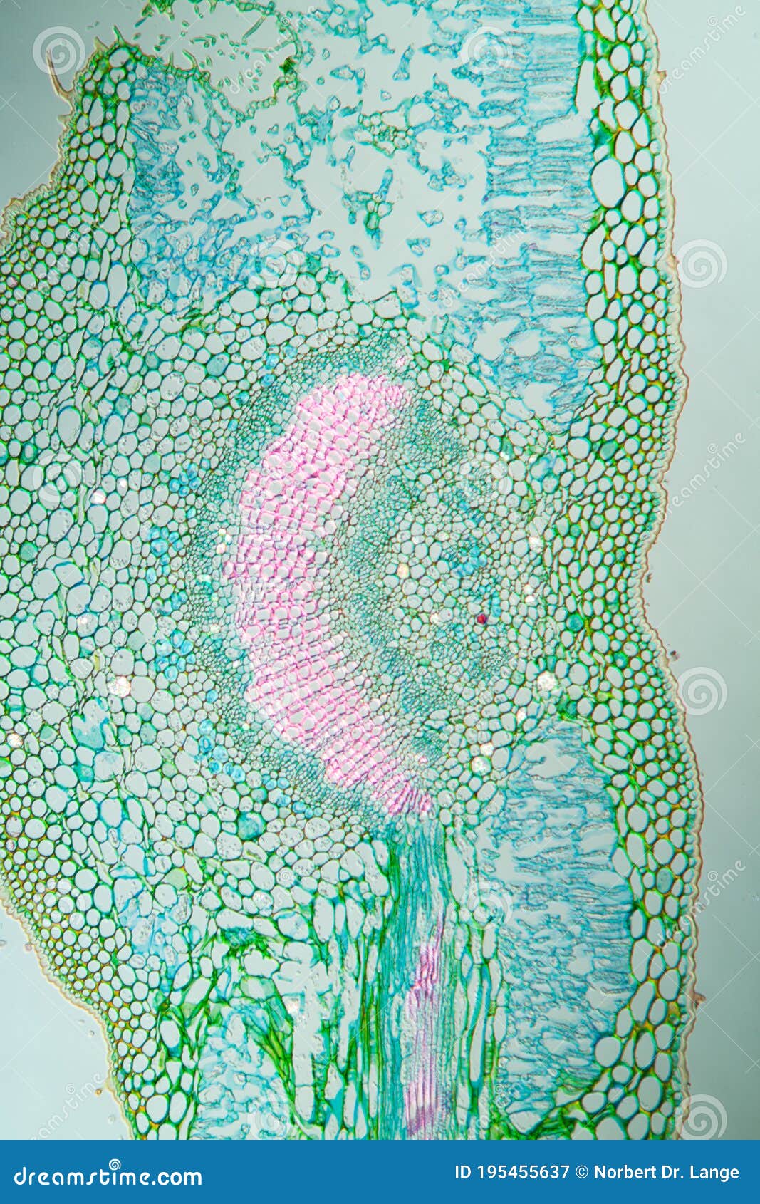 Weed Leaf Cross Section Under the Microscope Stock Image - Image of ...