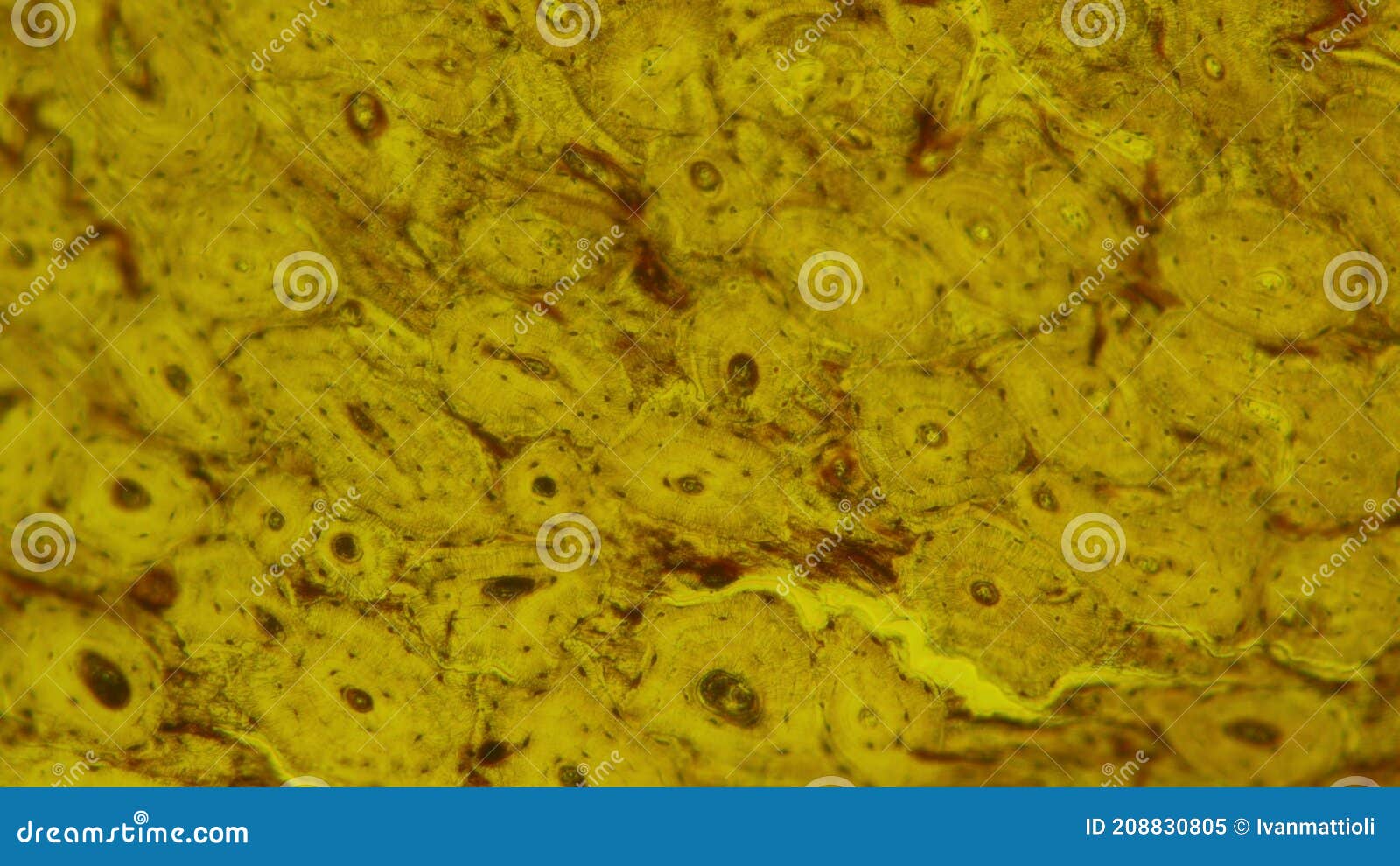 Weefsel Van Een Compact Bot Onder De Microscoop 400 X Stock Afbeelding ...