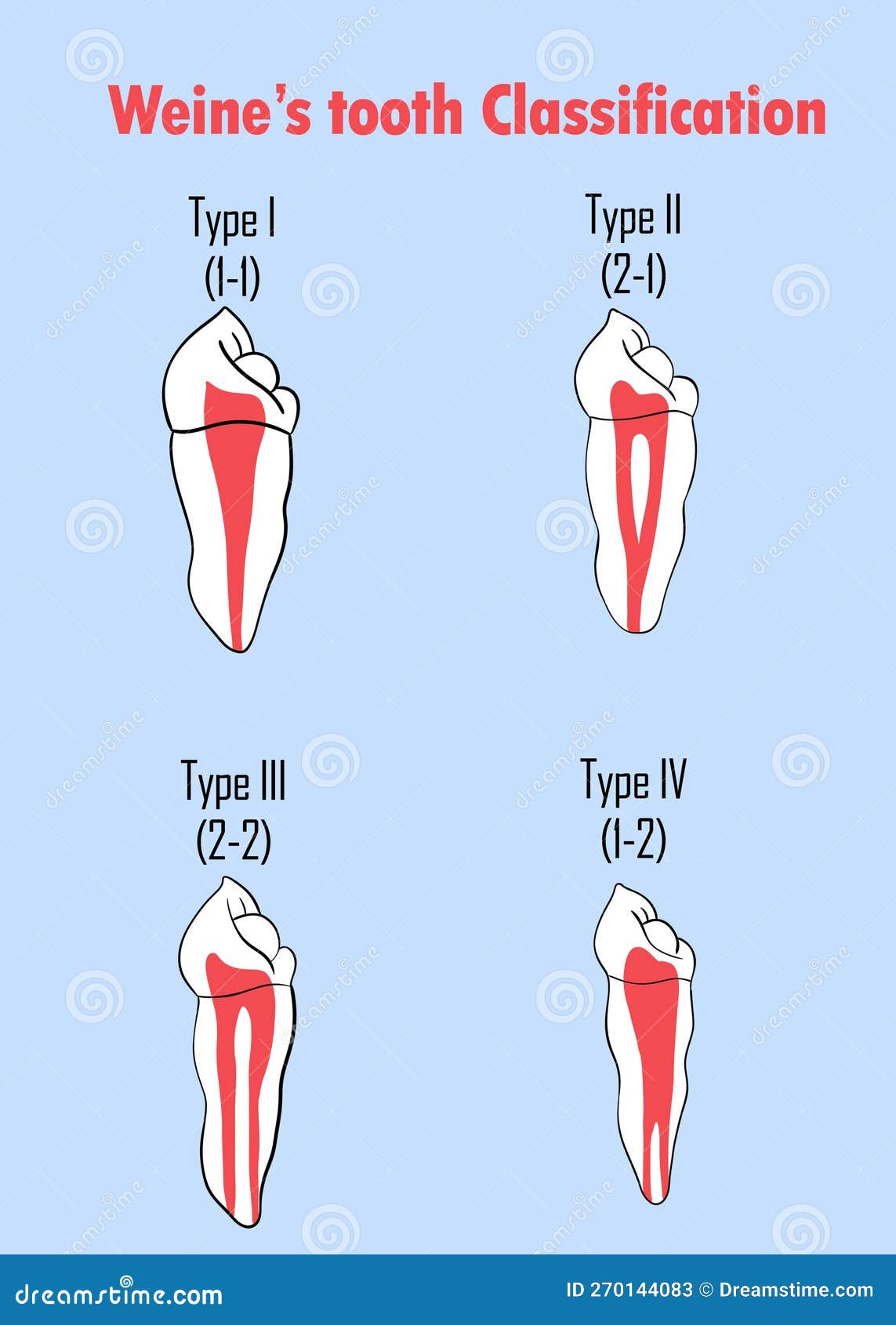 Weine S Classification of Root Canal Morphology from Type I To Type IV ...