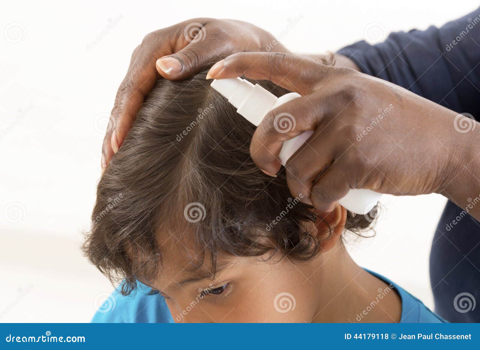 Weinig Behandeling Van Jongens Hoofdluizen Stock Foto - Image of ...