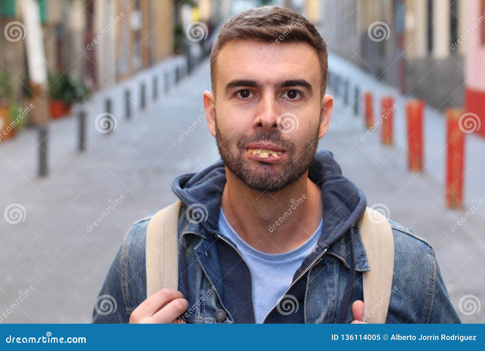 Weird Man with really Bad Teeth Stock Image - Image of disease, health ...