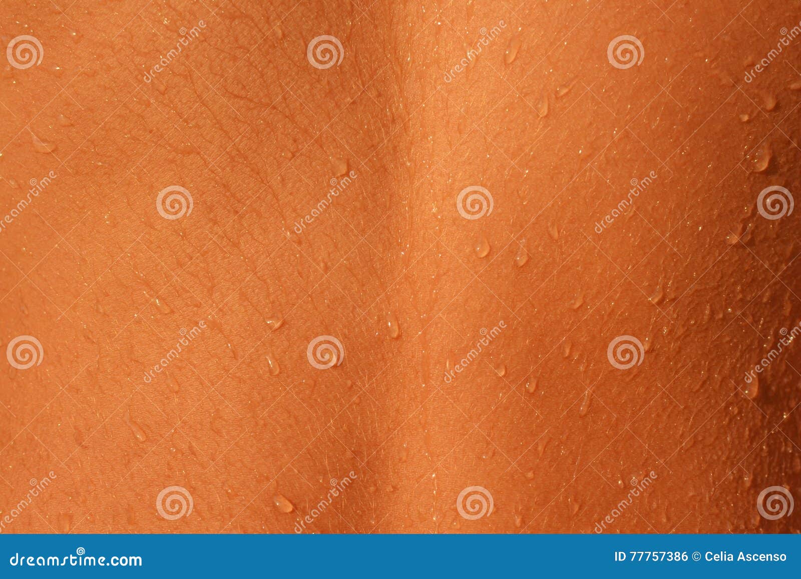 Human Skin. Pilosebaceous Unit Royalty-Free Stock Photography ...