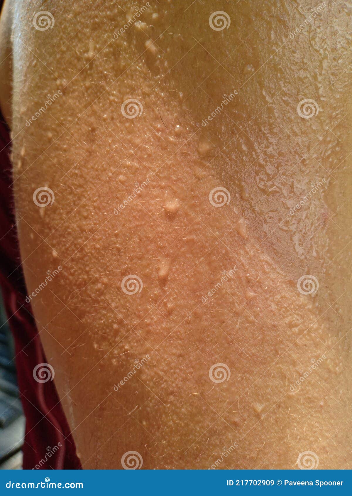 Wet and Sweaty Skin after Exercising Stock Image - Image of baking ...