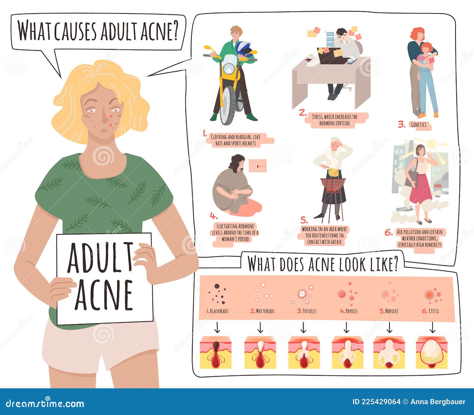 Causes Of Acne Skin Problems And Diseases Beauty Infographics Cartoon