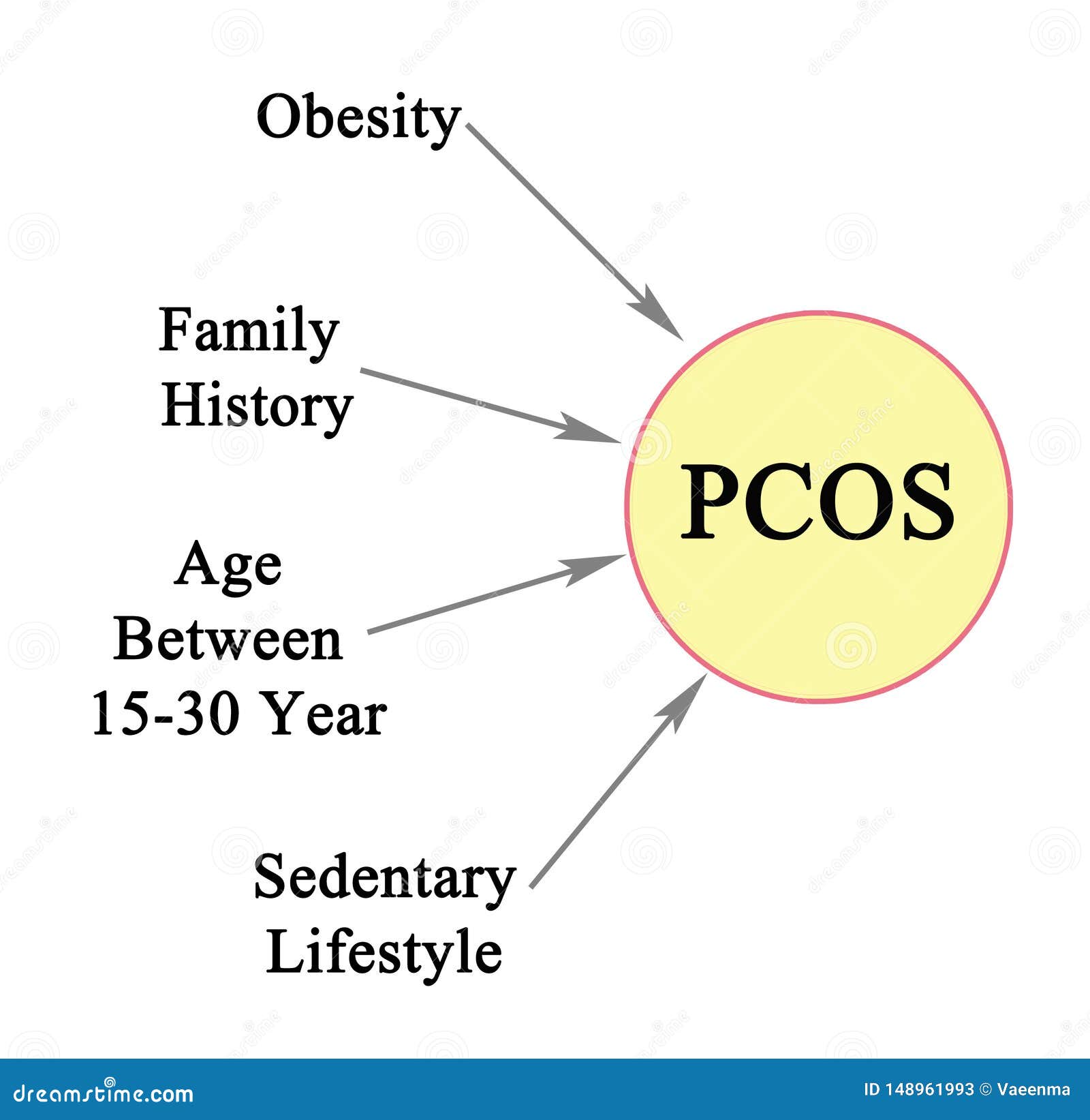 Polycystic Ovarian Syndrome Stock Illustration - Illustration of risk ...