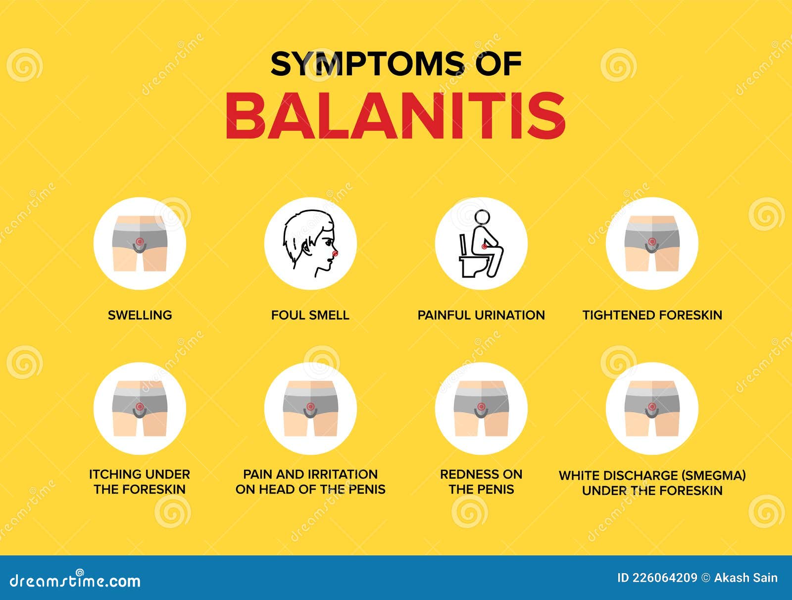 What are the Symptoms of Balanitis? Stock Vector - Illustration of ...