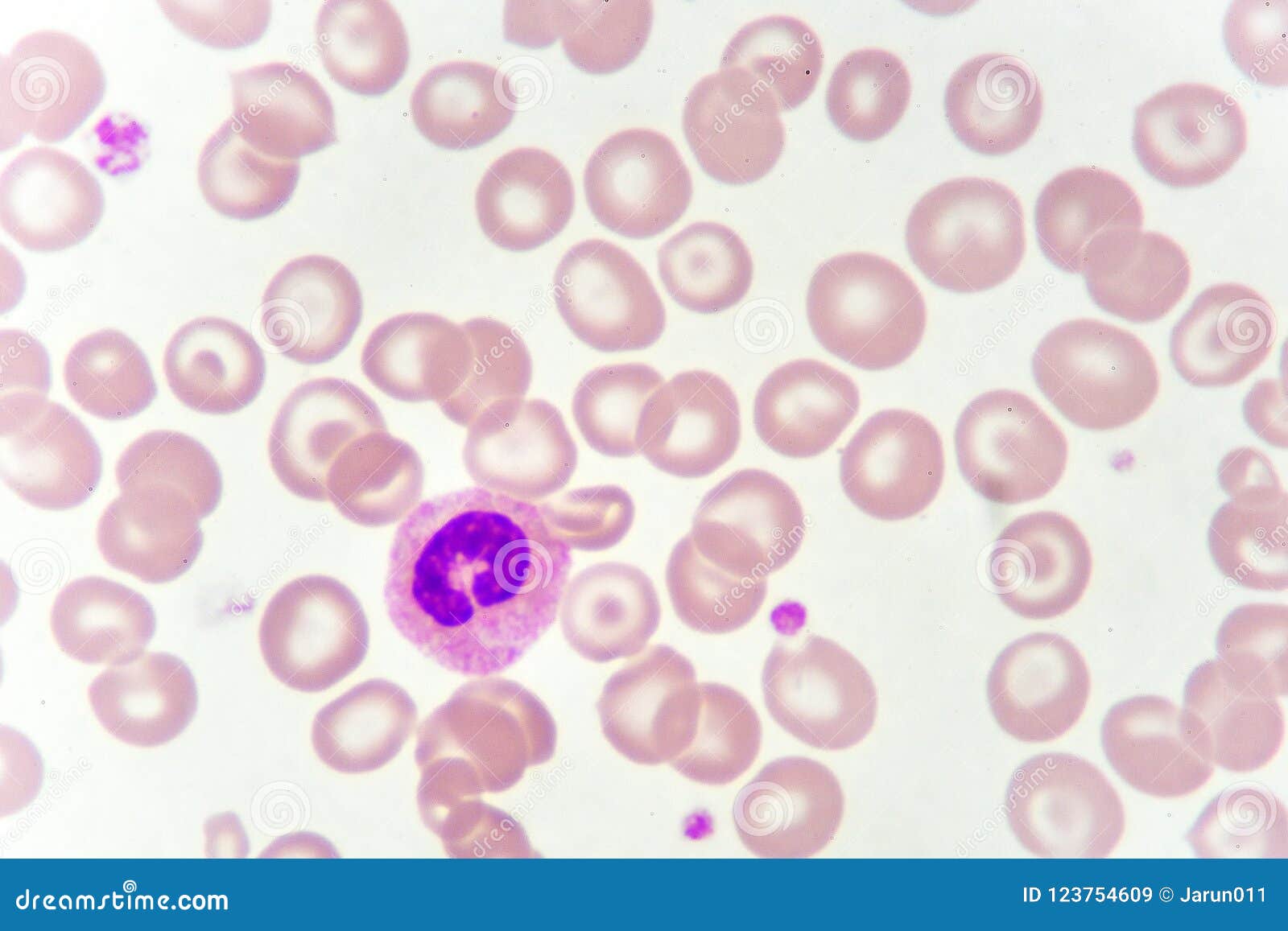 White Blood Cell in Blood Smear Stock Image - Image of hematology ...