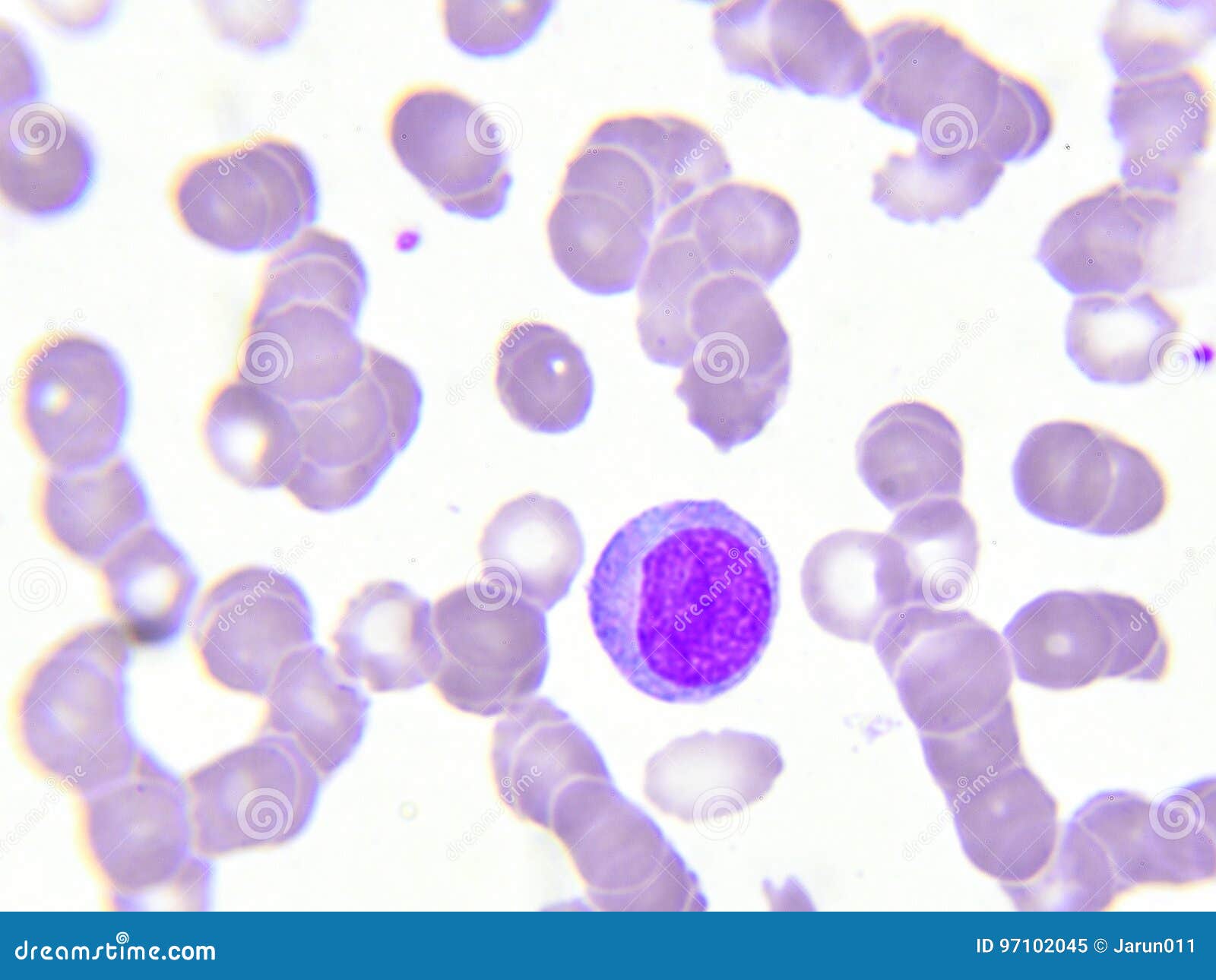 White blood cell stock image. Image of microscopic, analyze - 97102045