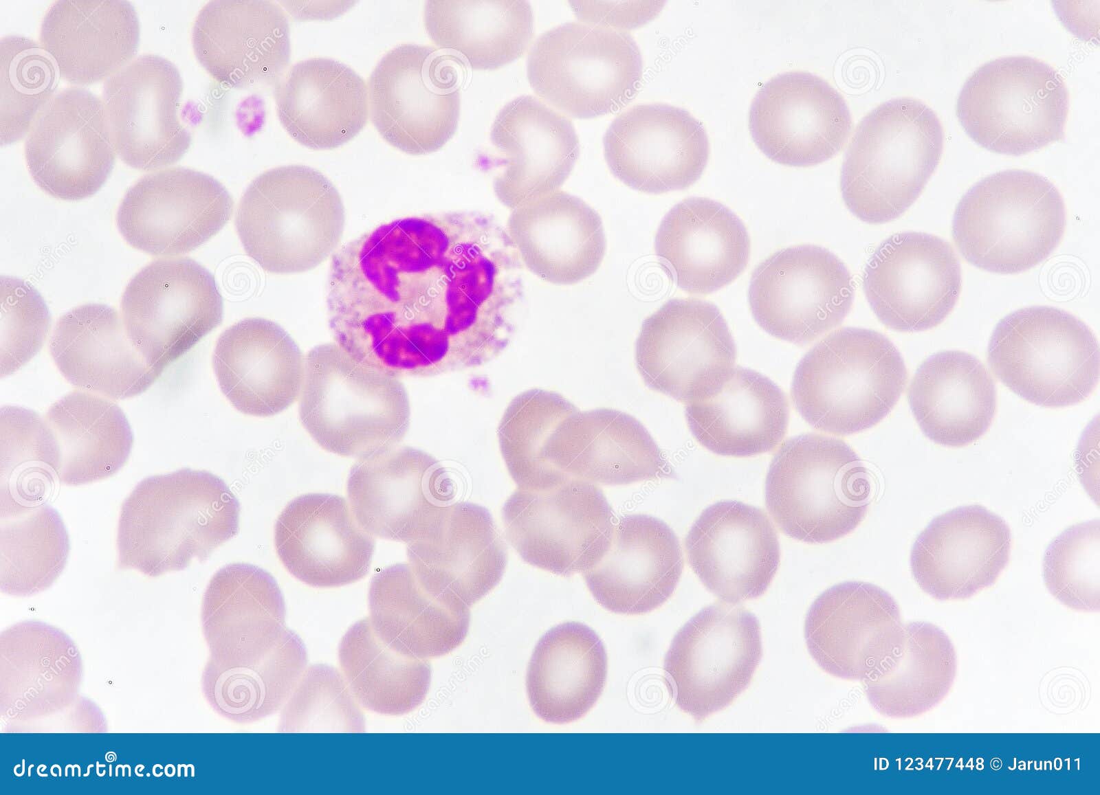 White Blood Cell in Blood Smear Stock Photo - Image of healthcare ...