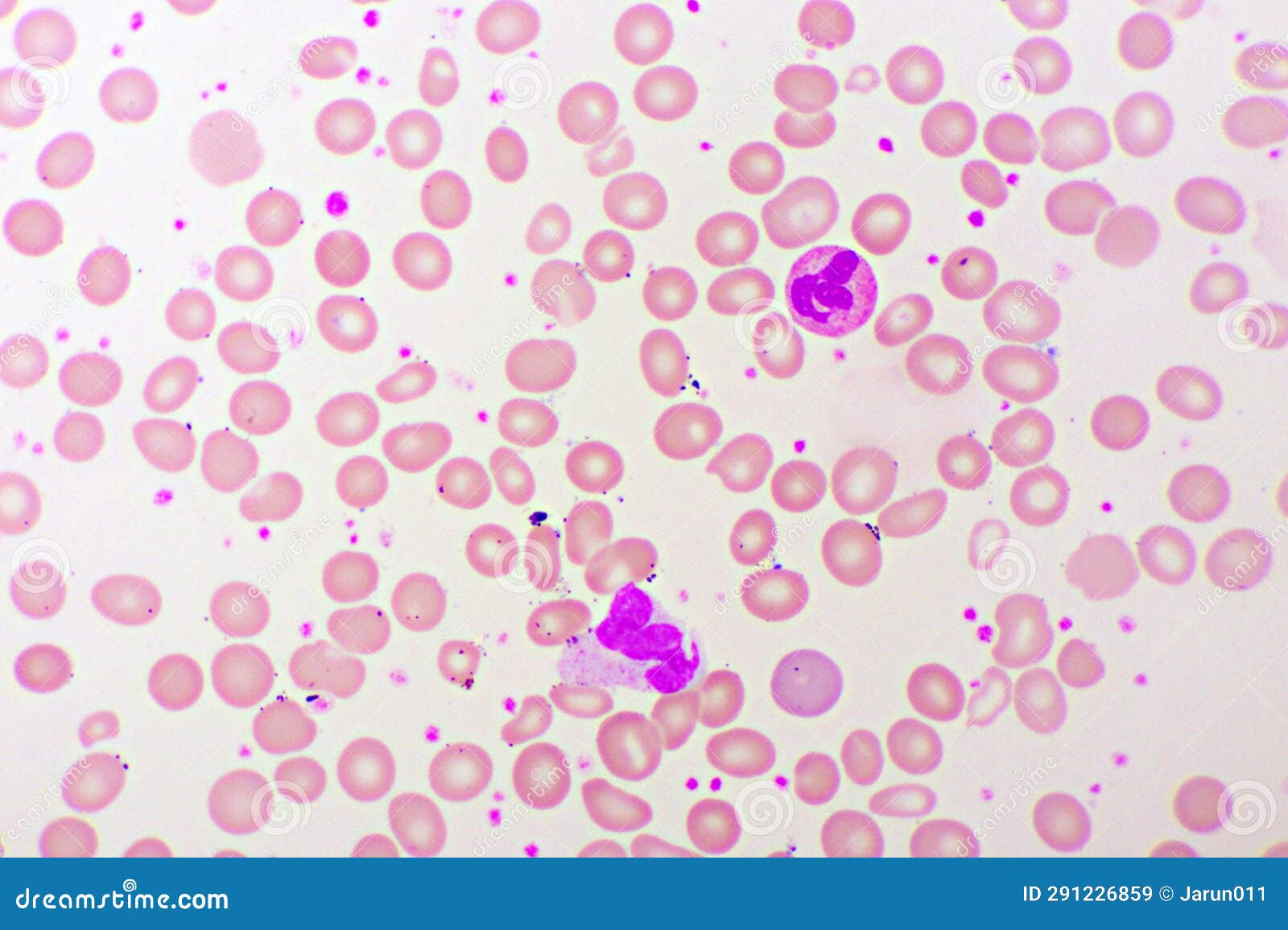 White Blood Cell in Blood Smear Stock Image - Image of analyze, exam ...