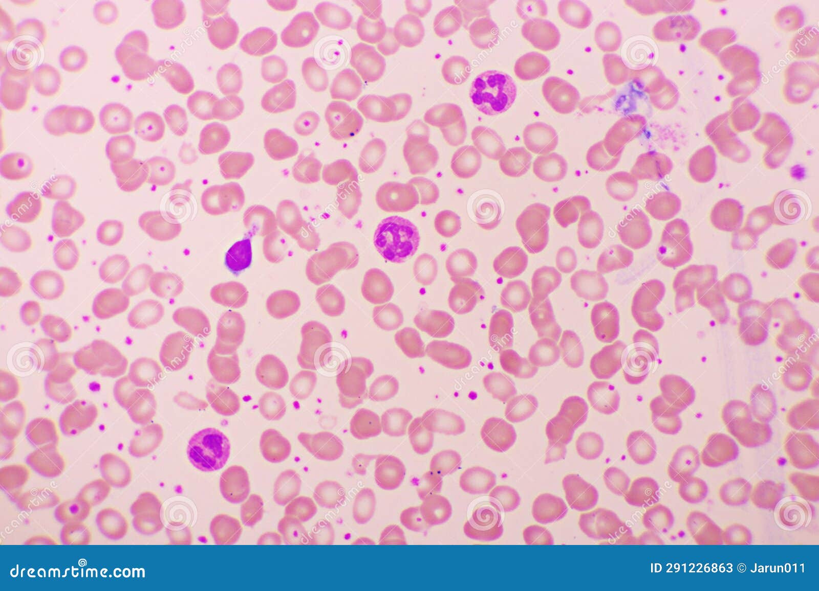 White Blood Cell in Blood Smear Stock Image - Image of test, segmented ...
