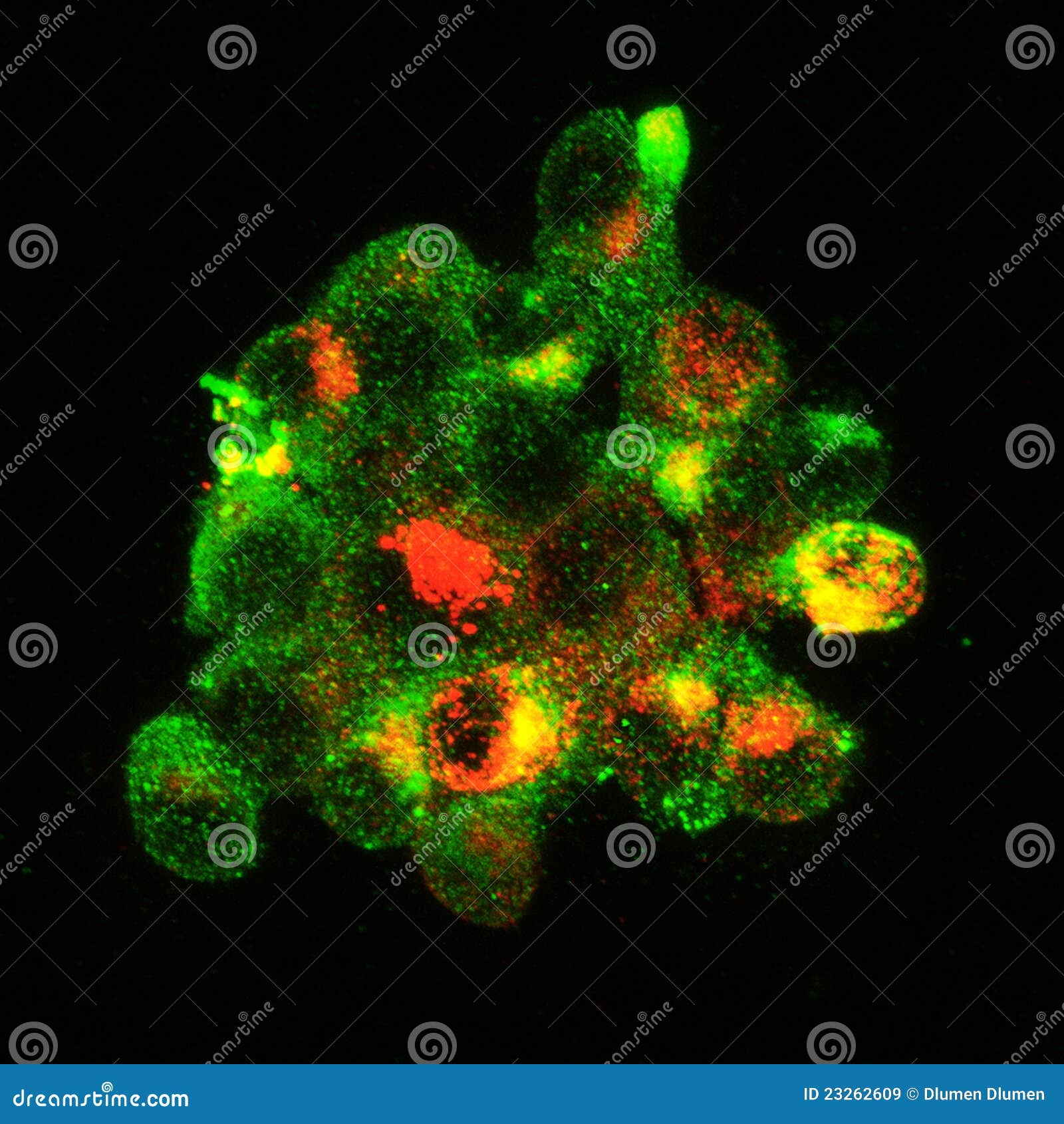 White Blood Cells Of A Human, Photomicrograph Panorama As Seen U ...