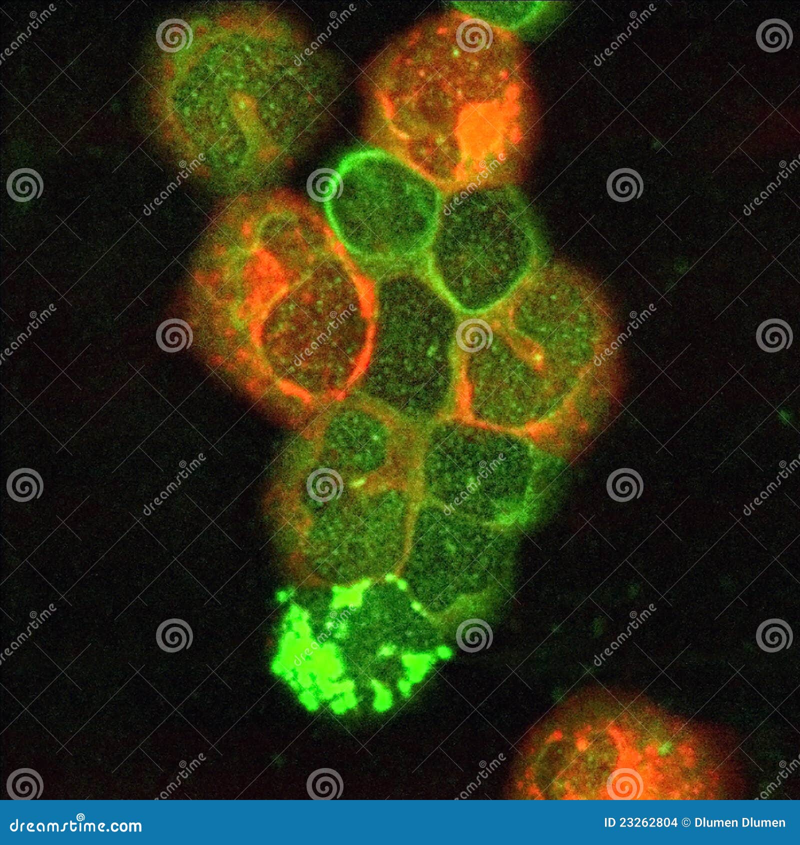 White Blood Cells stock photo. Image of neutrophils, bacteria - 23262804