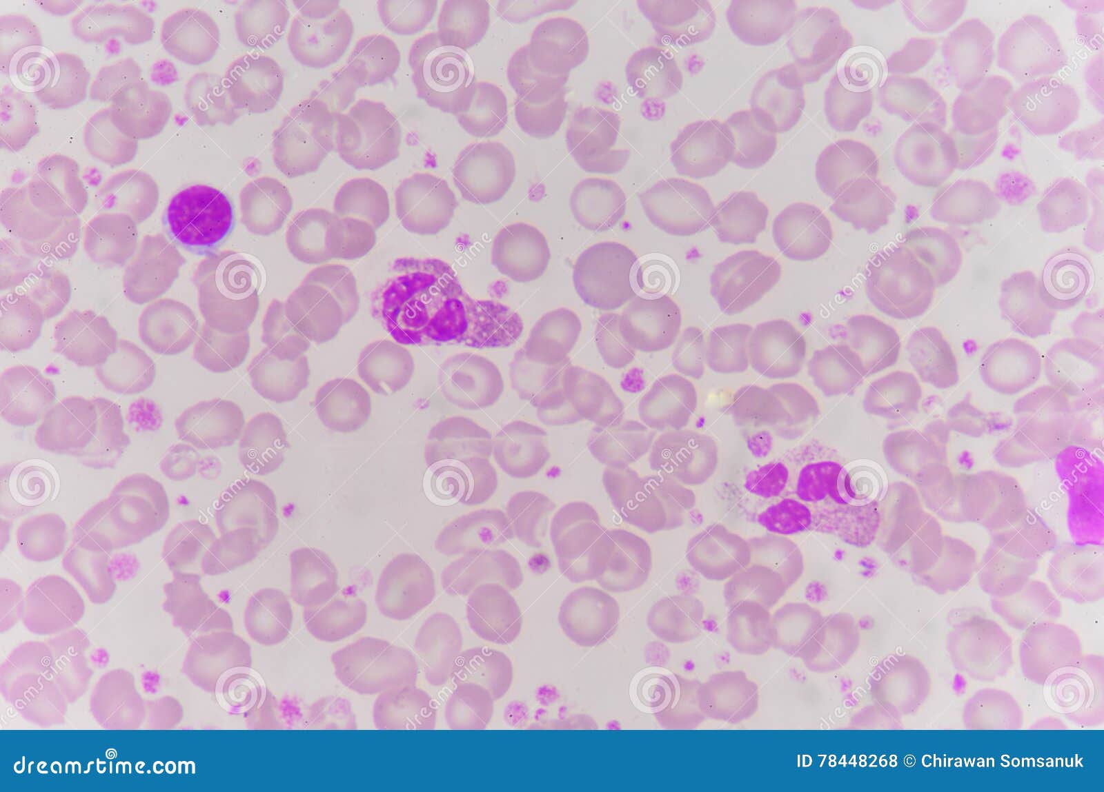 White Blood Cells Background. Stock Photo - Image of granulated ...