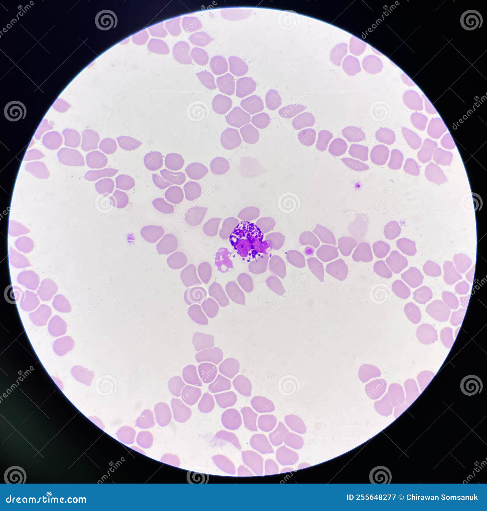 White Blood Cells Basophil on Rbc Background Stock Image - Image of ...