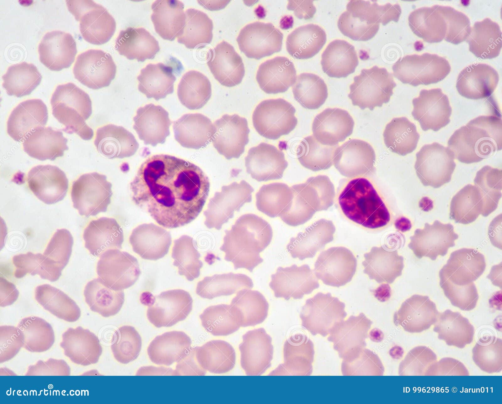 White blood cells stock image. Image of microscope, abnormal - 99629865