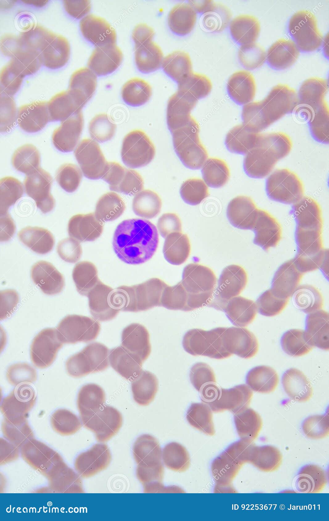 White blood cells stock image. Image of sample, hematopoiesis - 92253677