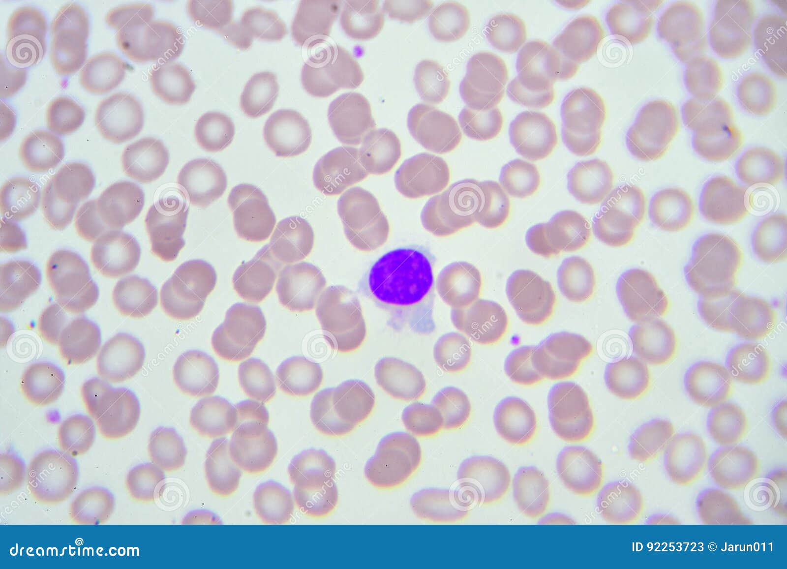 White blood cells stock image. Image of neutrophil, leukocyte - 92253723