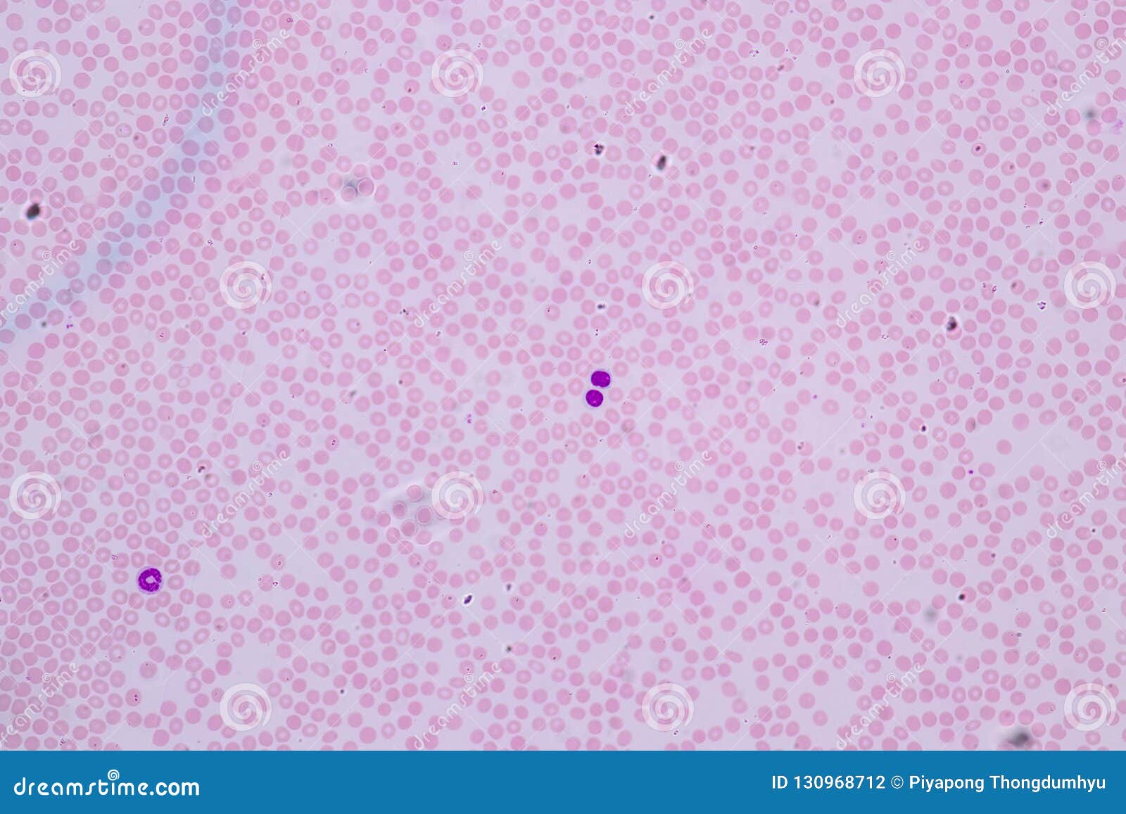 White Blood Cells are the Cells of the Immune System Under the ...