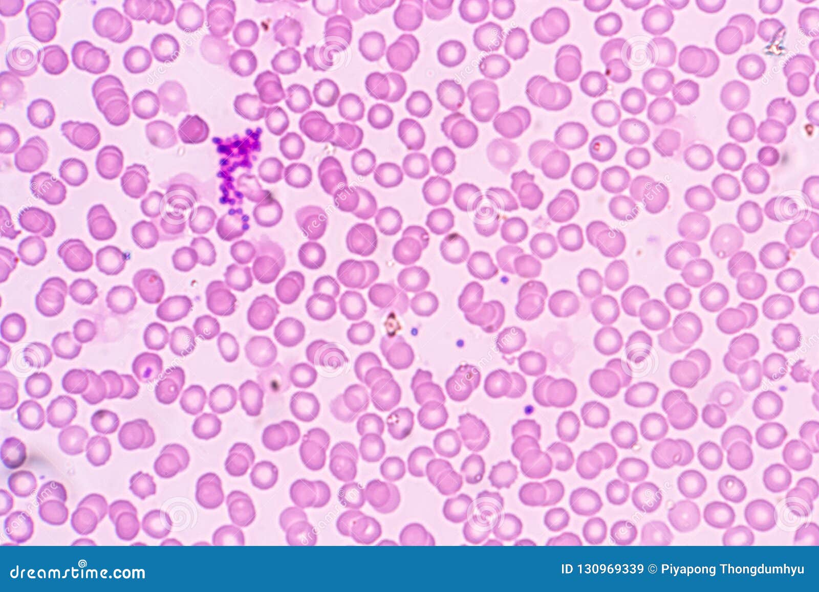 White Blood Cells are the Cells of the Immune System Under the ...