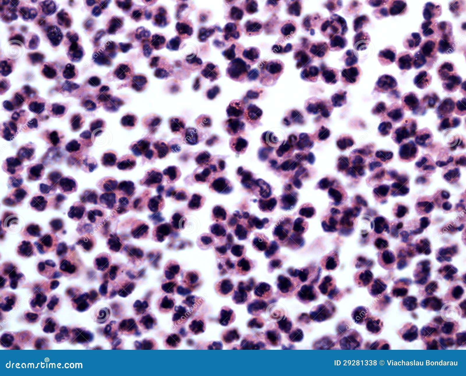 White Blood Cells Of A Human Royalty Free Stock Photos - Image: 29281338