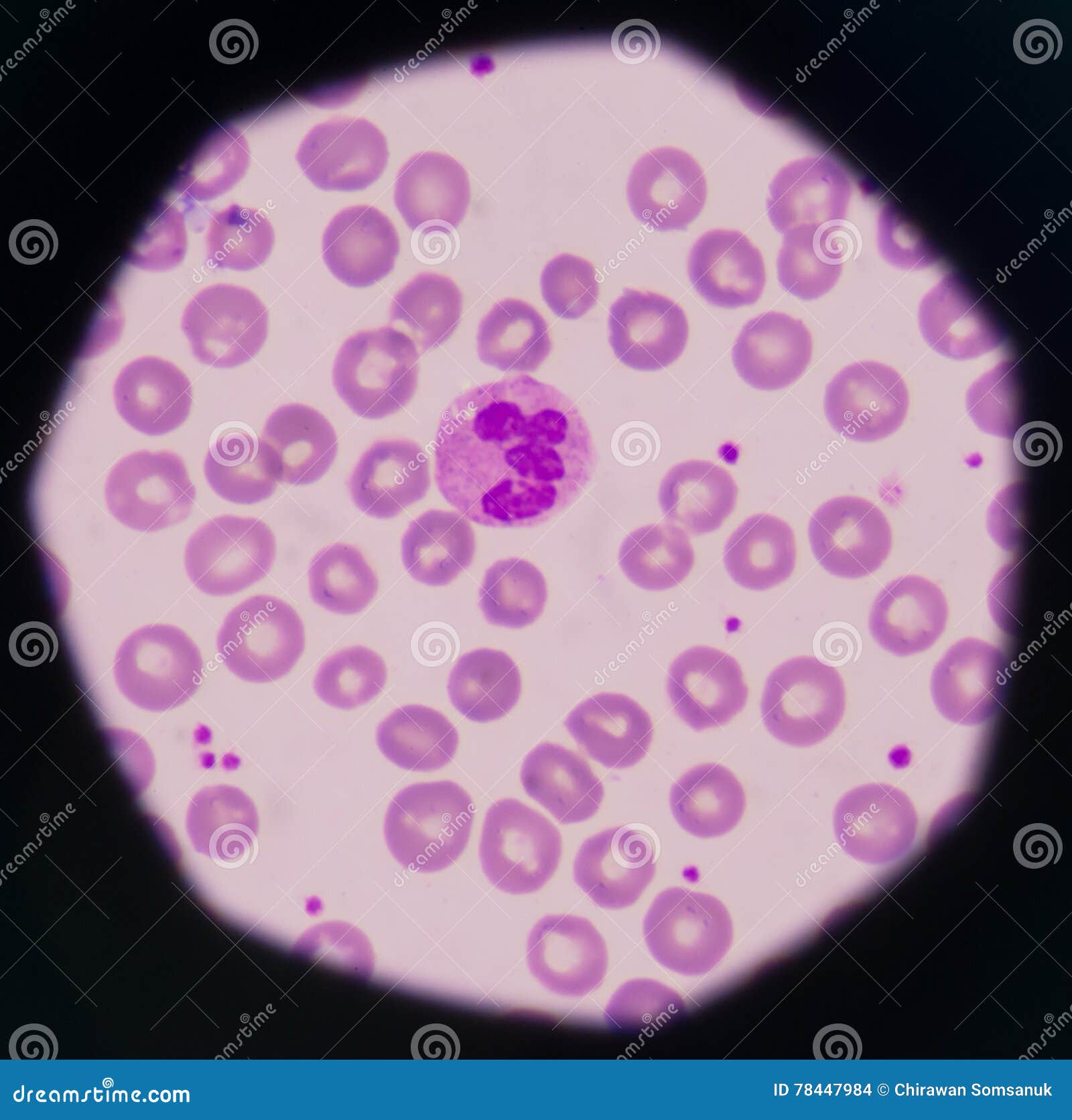 Embryonic Mitosis Stem Cells Colony Tissue Section Magnified Under A ...