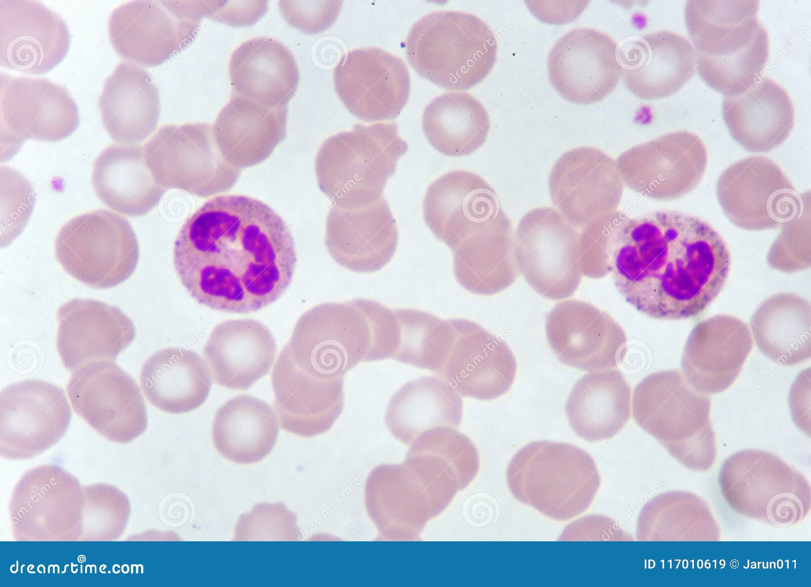 White Blood Cells in Blood Smear Stock Image - Image of care ...