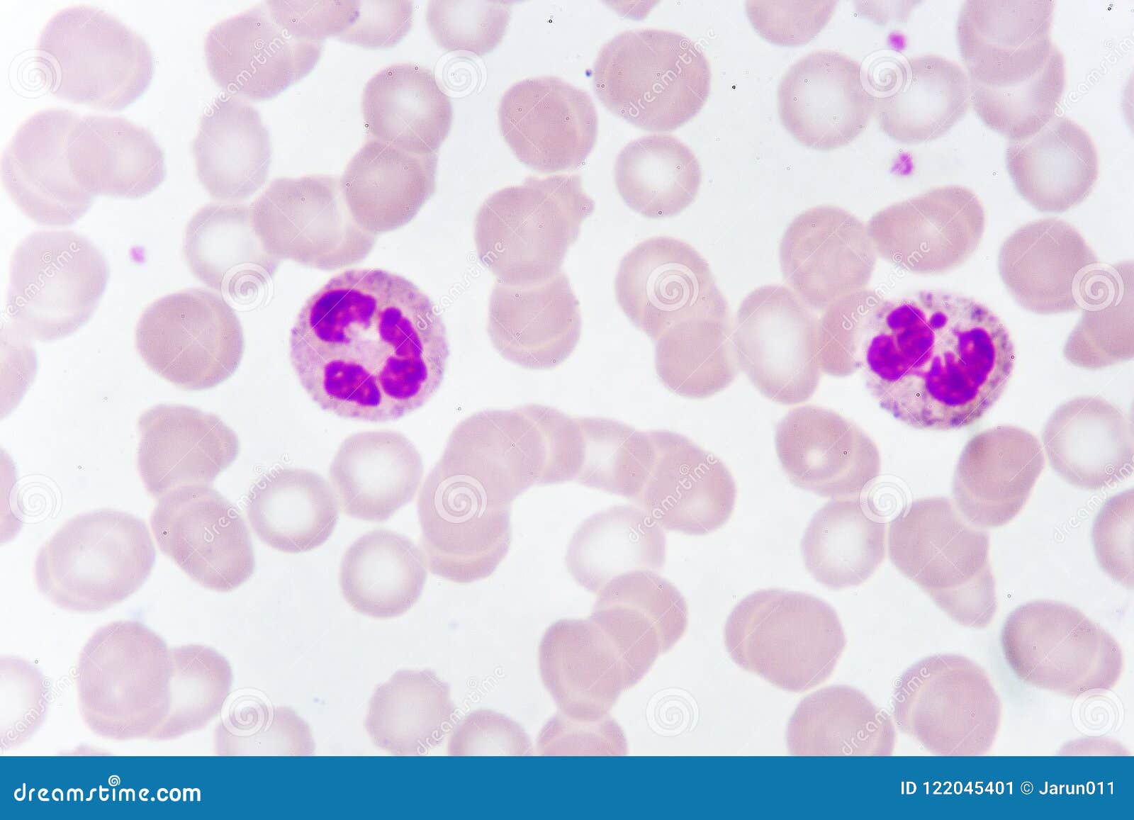 White Blood Cells in Blood Smear Stock Image - Image of leukocyte ...