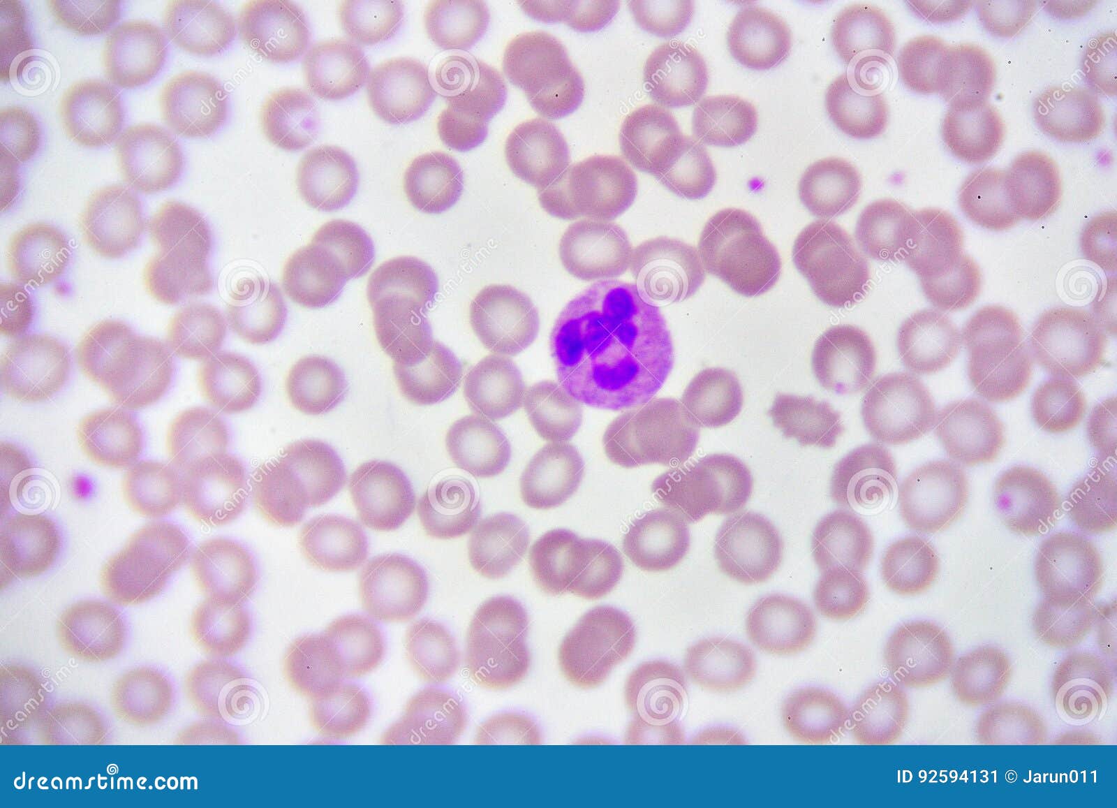 White blood cells stock image. Image of health, pathology - 92594131