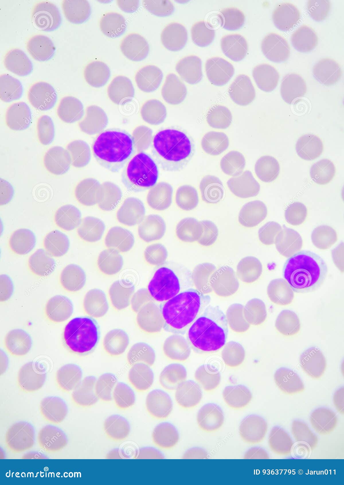 White blood cells stock image. Image of microscope, microscopic - 93637795