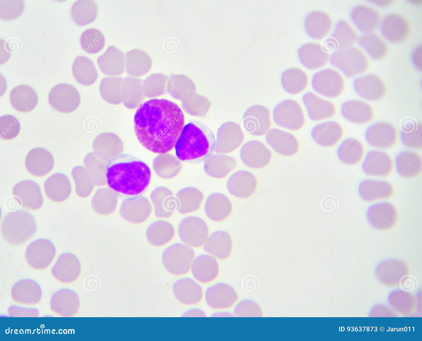 White blood cells stock image. Image of checkup, care - 93637873