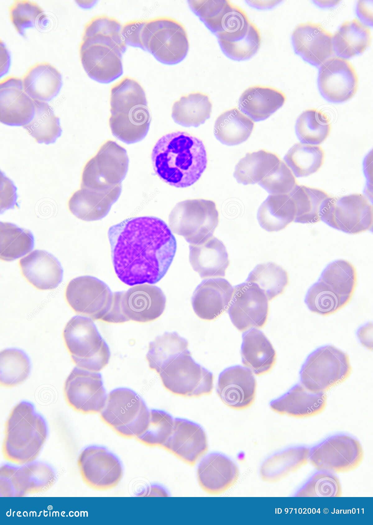 White blood cells stock photo. Image of microscopic, care - 97102004