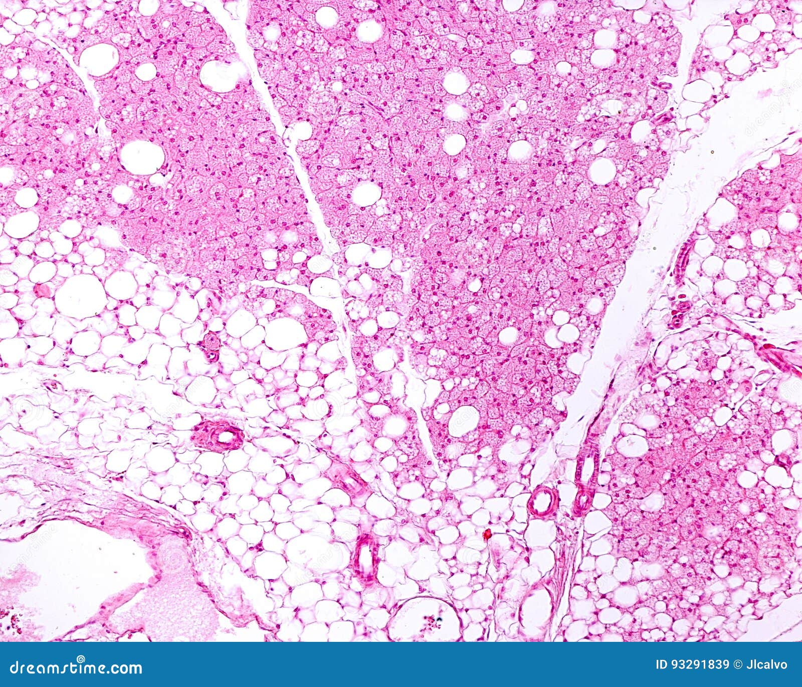 White and brown fat stock image. Image of unilocular - 93291839