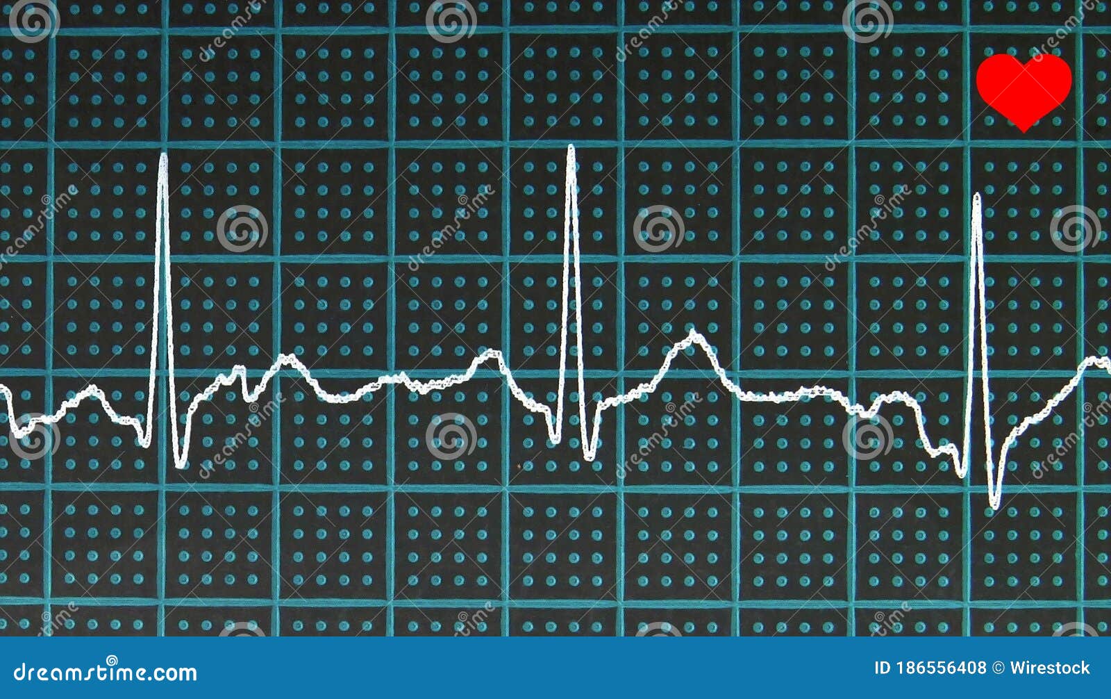 White Cardiogram on a Blue and Black Square Shaped Background Stock ...