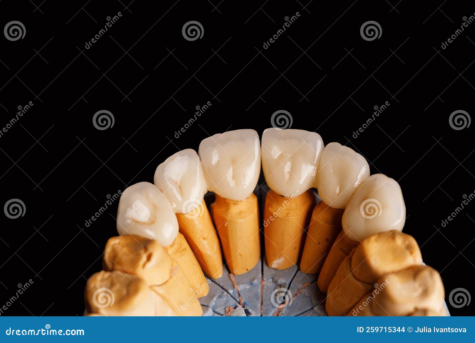 White Ceramic Teeth on Black Background Stock Photo - Image of ...