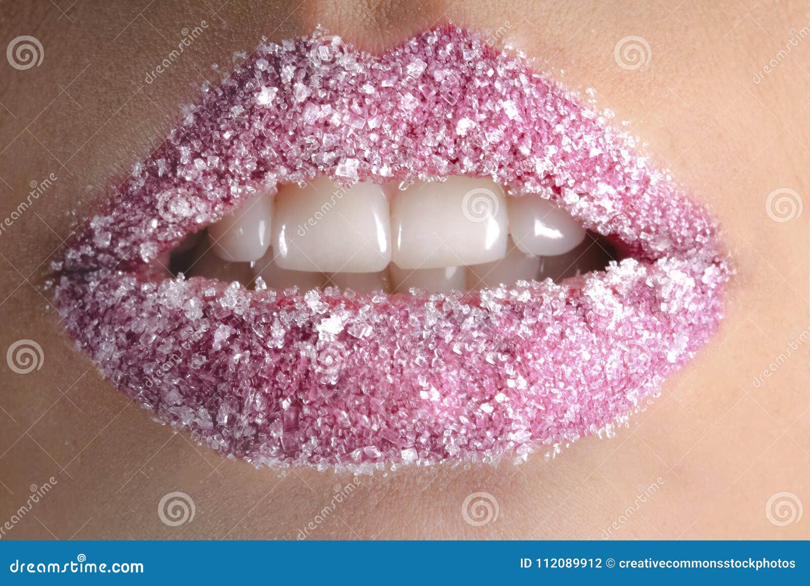 White Granules On Person Lips Picture. Image: 112089912