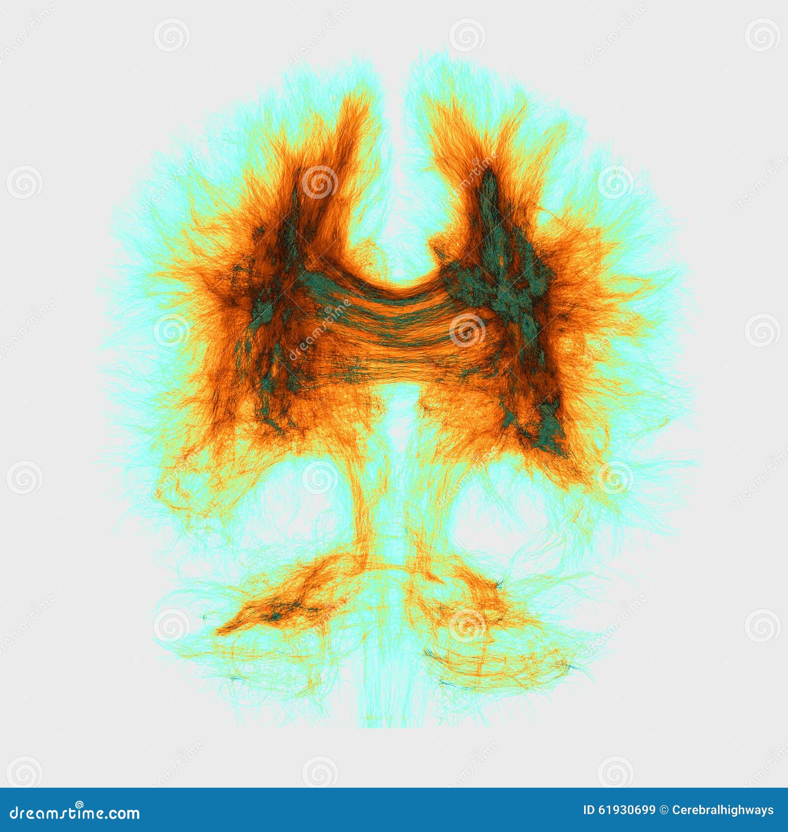 White Matter Tractography of the Human Brain Stock Illustration ...