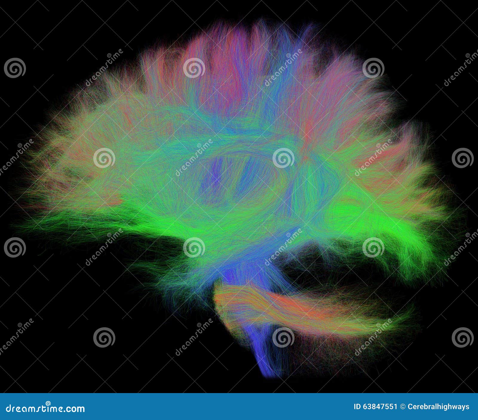White Matter Tractography of the Human Brain in Sagittal View Stock ...