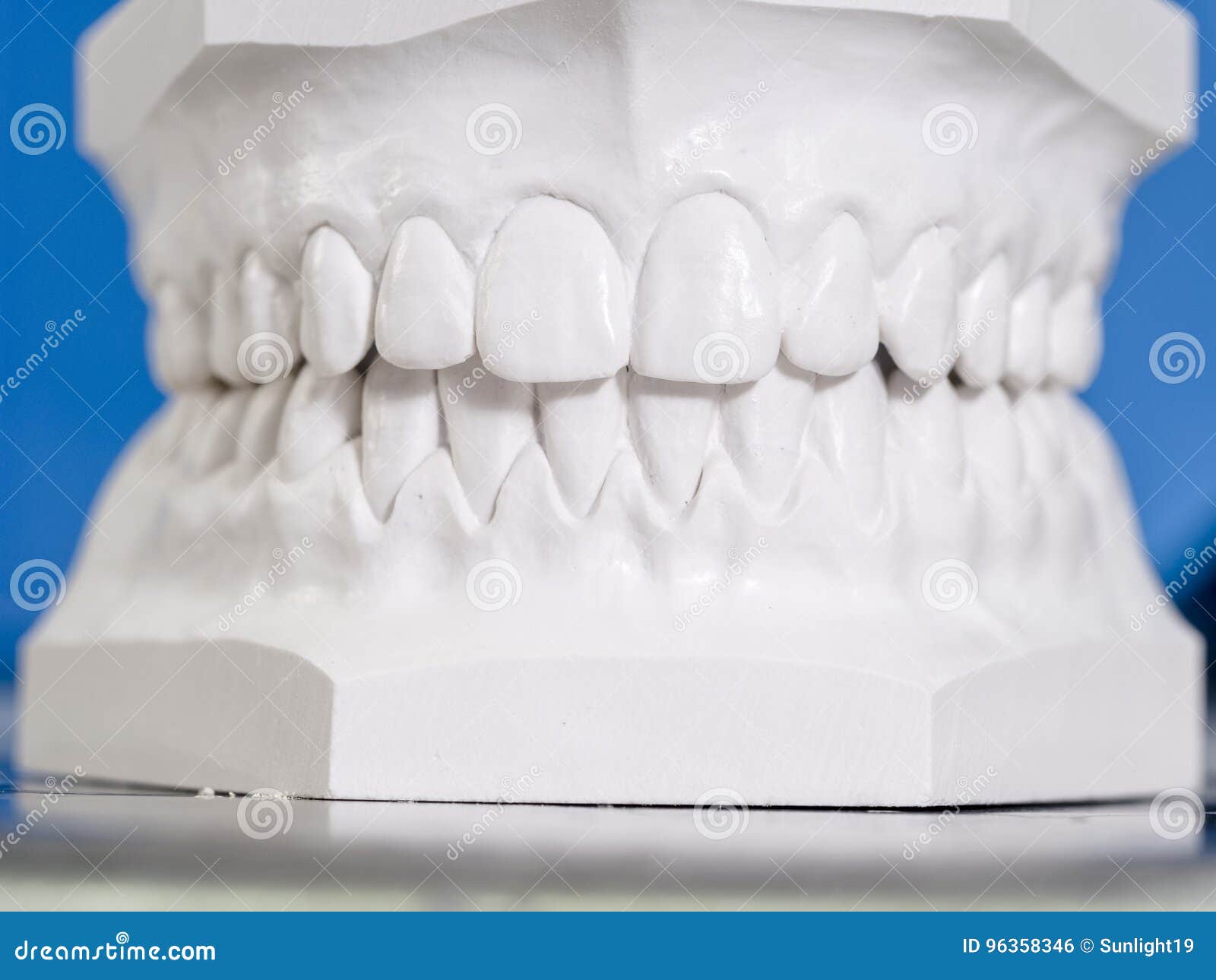 White Mold Dental of Plaster Stock Photo - Image of medicine, model ...