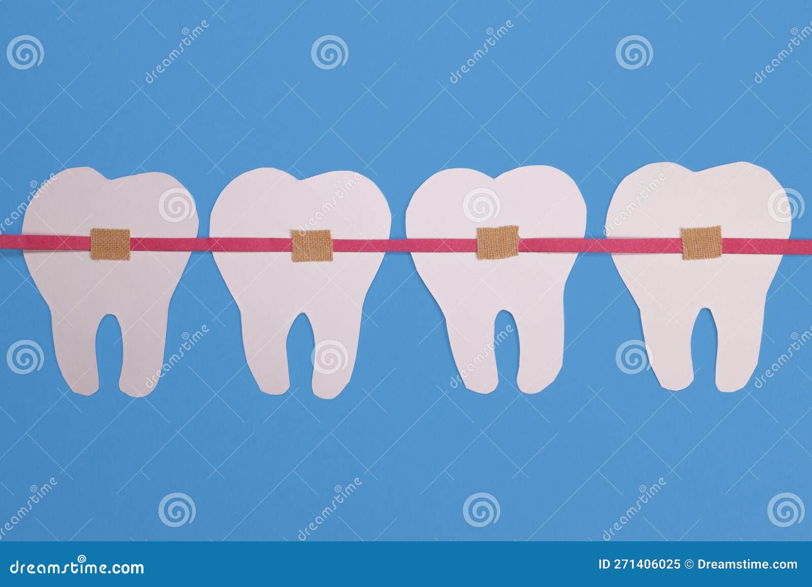 White Paper Teeth in Dental Braces on a Blue Background Stock Image ...