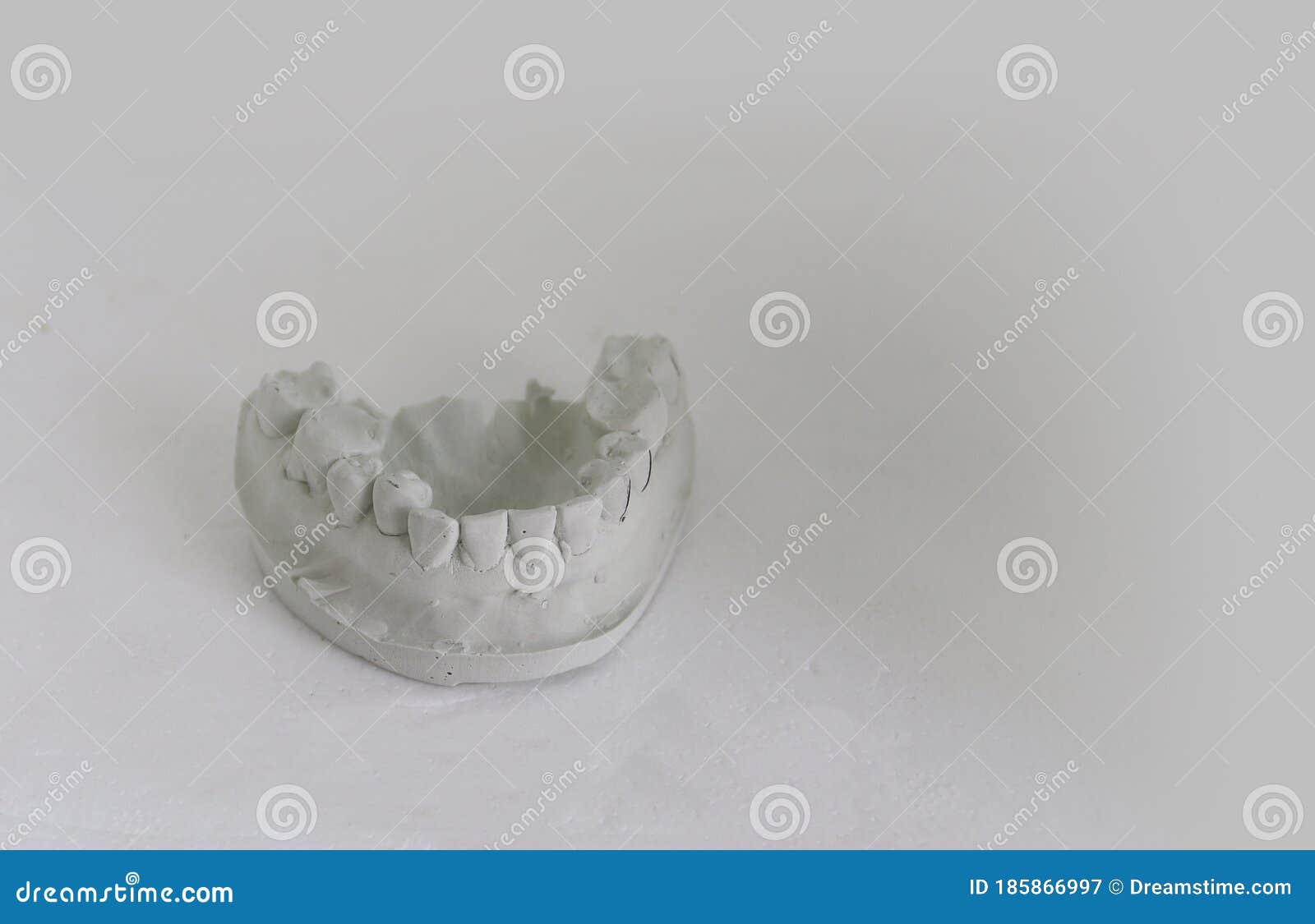 White Plaster Impression of Lower Teeth Isolated on White Background ...