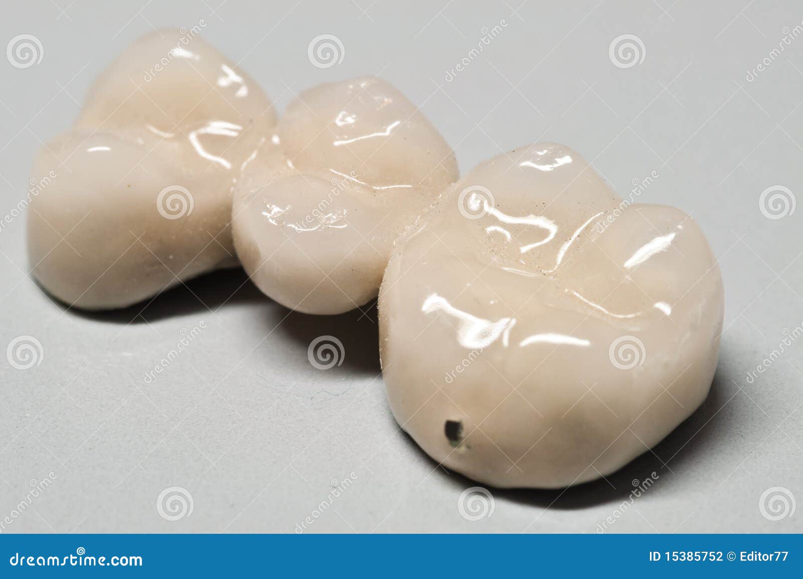 White Porcelain Dental Crown Model Stock Photo - Image of yellow, tooth ...