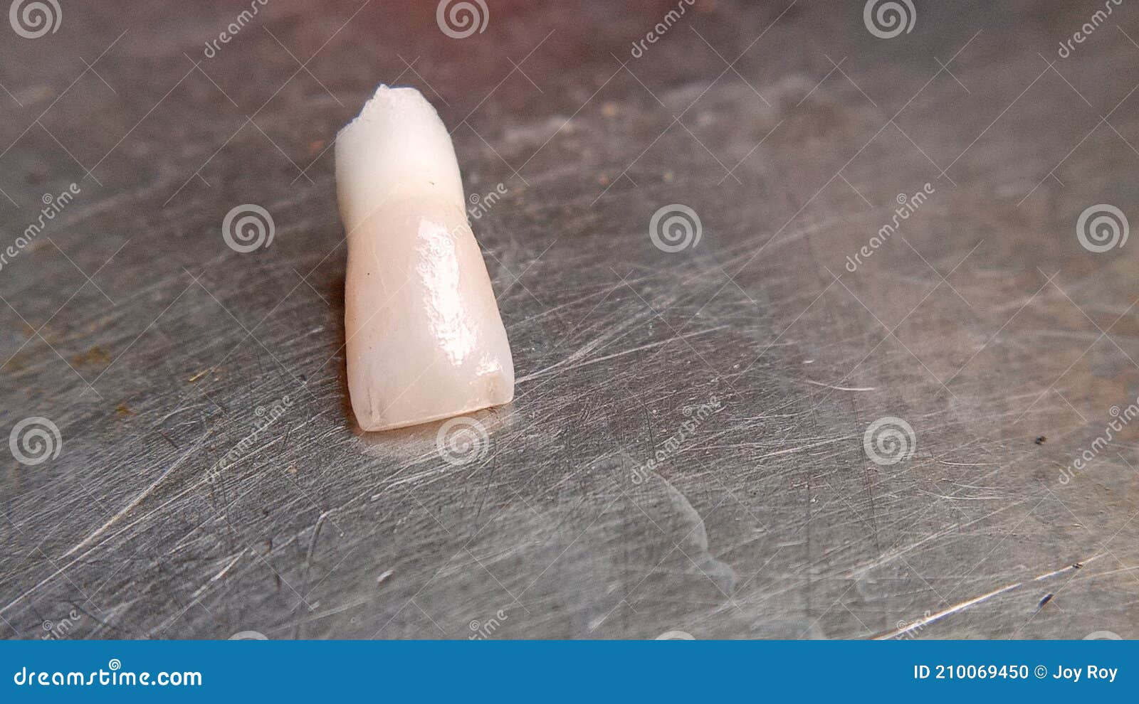 White and Sharp Kid Tooth. stock photo. Image of object - 210069450