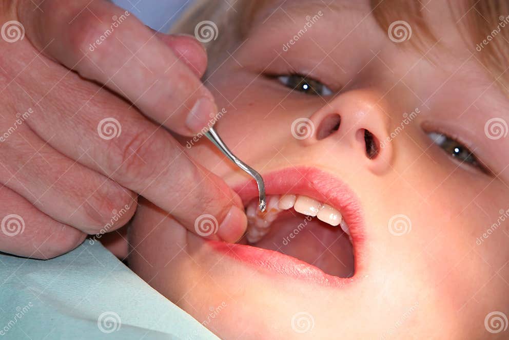 White teeth stock photo. Image of open, tools, hands, medical - 1009890