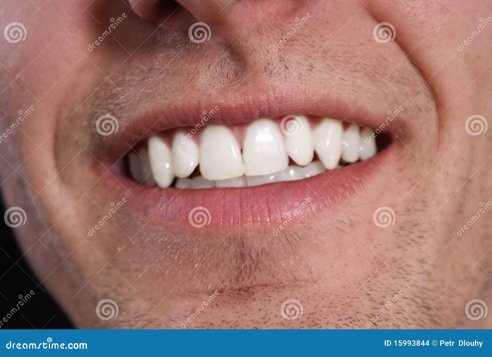 White teeth stock photo. Image of casual, teeth, dentistry - 15993844