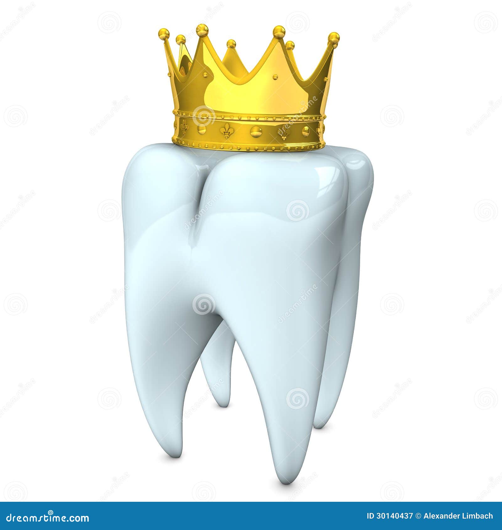White Gold Tooth Crown