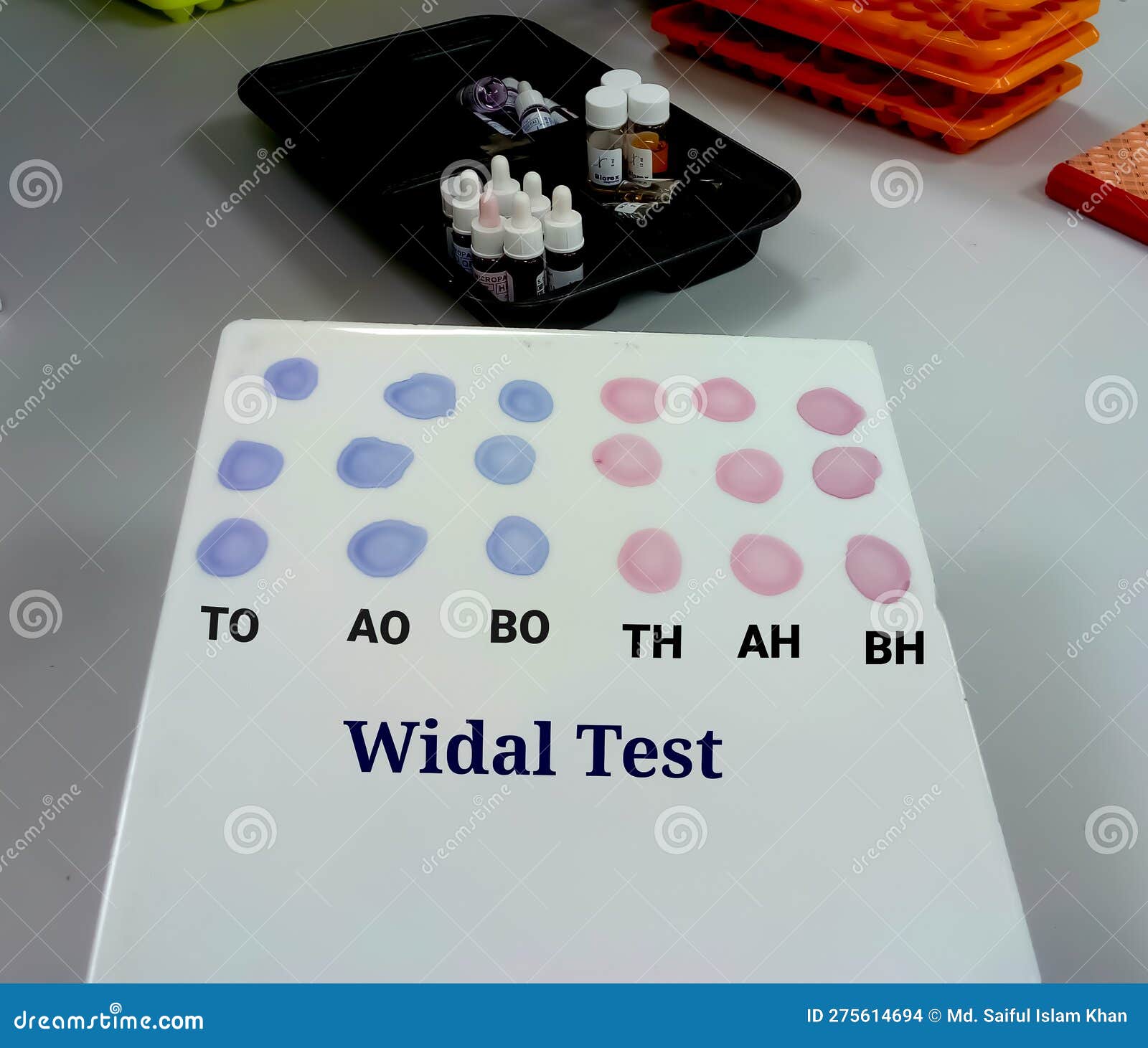 Widal Stock Photos - Free & Royalty-Free Stock Photos from Dreamstime