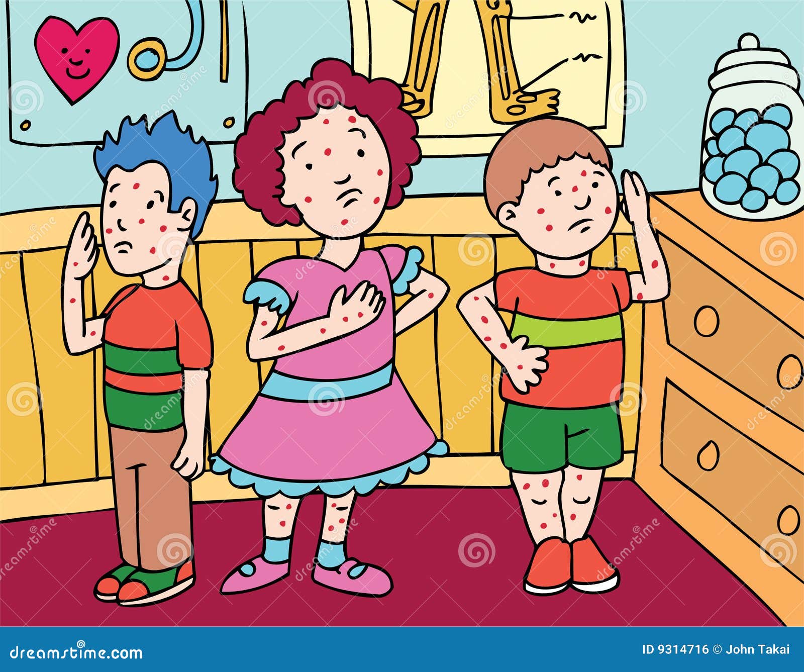 Windpocken vektor abbildung. Illustration von dekoration - 9314716