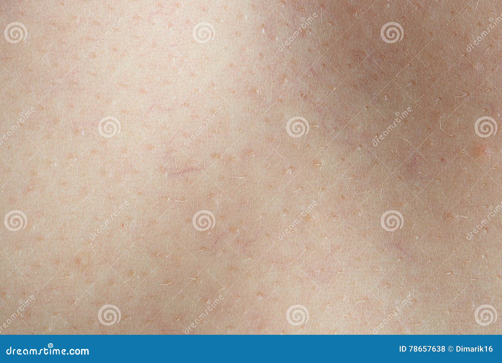 Wirkliche menschliche Haut stockfoto. Bild von haut, auszug - 78657638